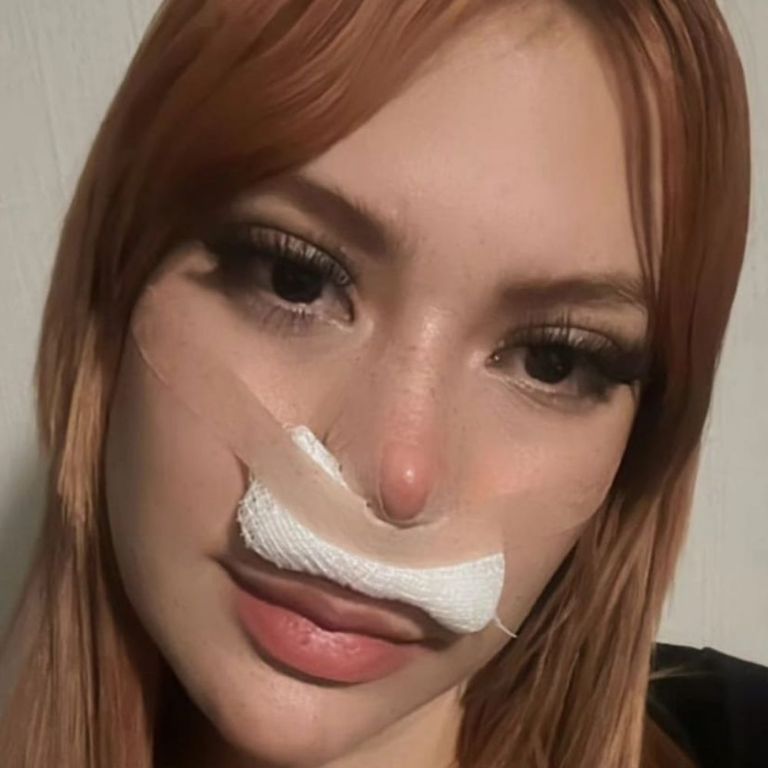 Alex Marín: Su novia Sofía Marín aparece en redes con vendajes en la cara ¿Qué le pasó? - FM Globo